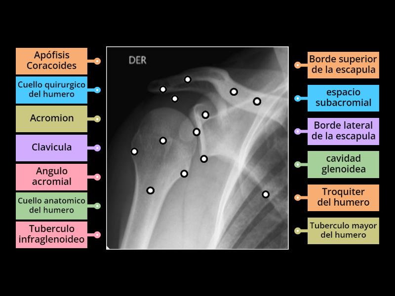 Anatomia de rx Hombro - Diagrama con etiquetas